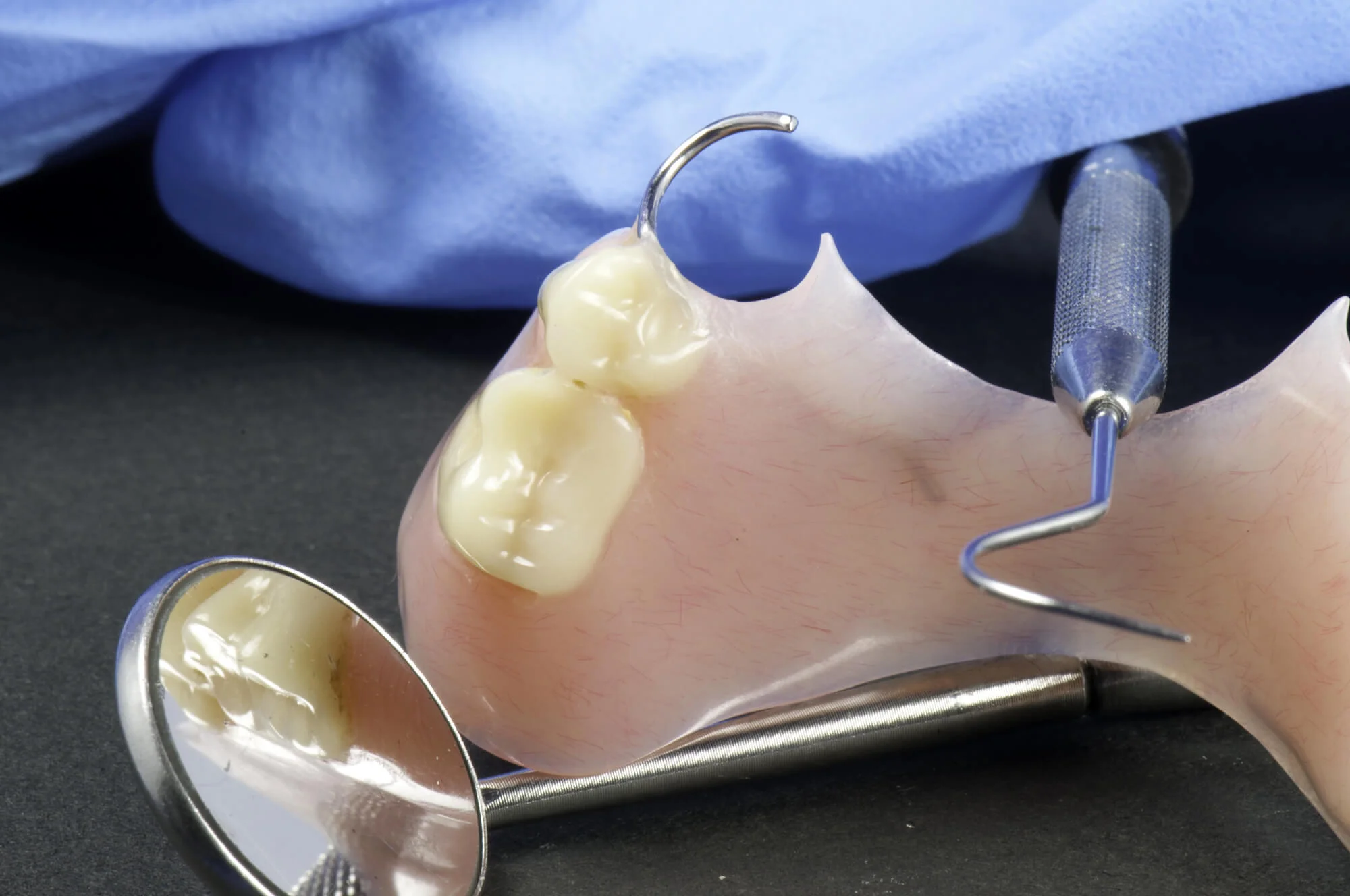 Can Dental Bridges Improve Both Function and Appearance?